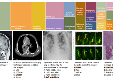 所见，所问，所答：上海交大&上海AI Lab发布最新医疗多模态问答框架PMC-VQA-AITOP100,AI资讯